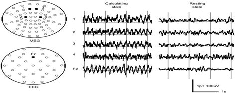 Medial Prefrontal Cortex Generates Frontal Midline Theta Rhy