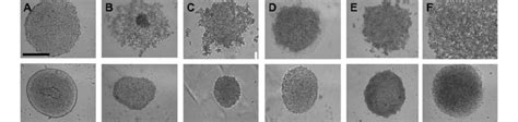 Formation Of Spheroids From Nonbreast Cancer Cell Lines Using Download Scientific Diagram
