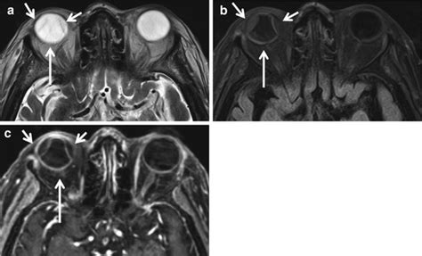 Orbits Radiology Key Orbits Radiology Key