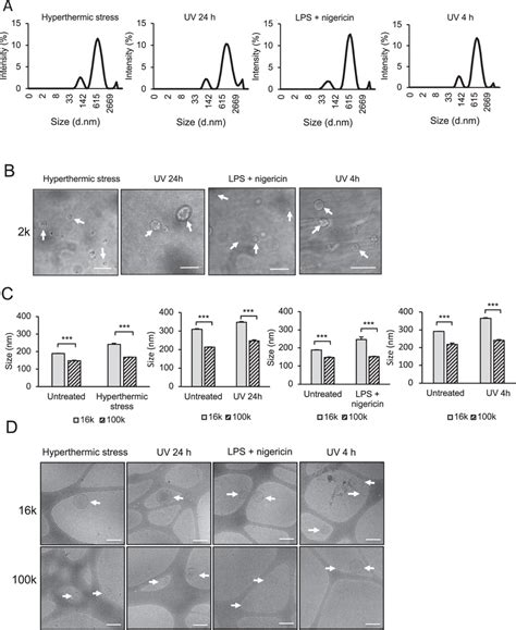 Evs Released By Thp 1 Cells Under Conditions Of Membrane Lytic Cell