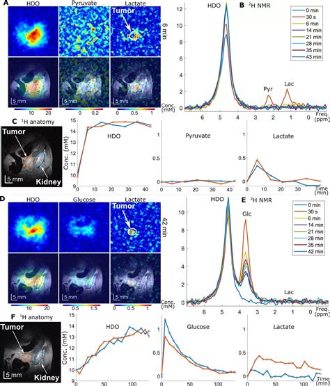 Medicine Research New Mri Method Uses Altered Glucose To Light Up