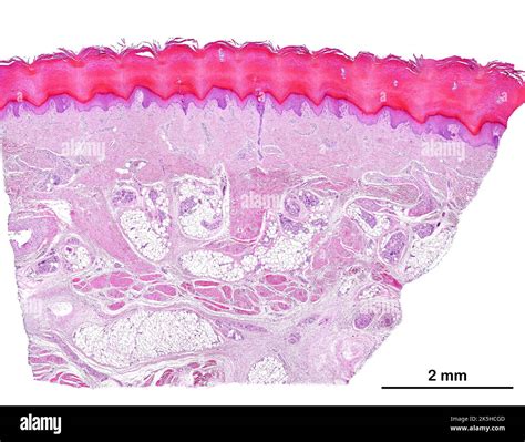 Low Power Light Microscope Micrograph Of Human Glabrous Skin From Top