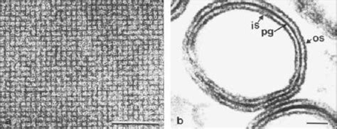 Electron Micrographs From A Negatively Stained And B Download