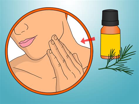 How To Get Rid Of Shaving Rash Steps With Pictures How To Get Rid Of Shaving Rash Steps With Pictures