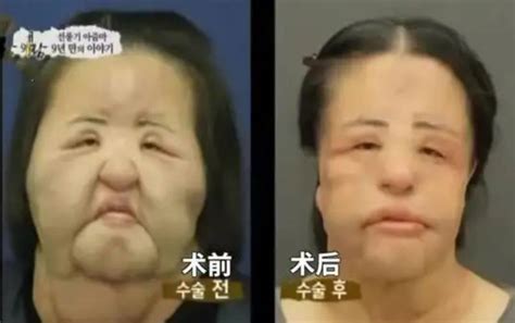 美貌被星探看中！她自行注射沙拉油「把臉整成電風扇」毀前程 「整容前美照曝光」網愣：根本女神 趣聞圖說