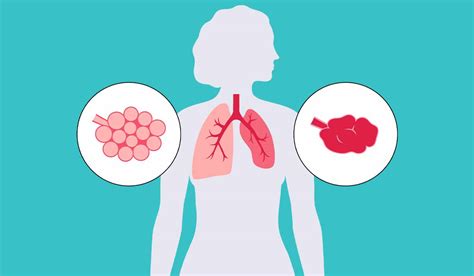 Hypoxia What Is Types Causes Symptoms And Treatment