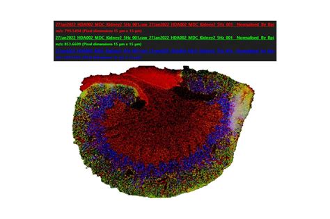 Maldi Mass Spectrometry Imaging Matrix Assisted Laser Desorption