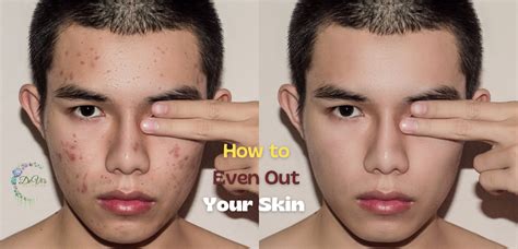 Even Out Your Skin Tone Simple Step By Step Guide Devis Naturals