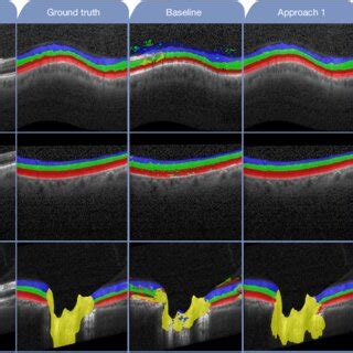 Example Segmentation Results Of The Different Scan Patterns Approach