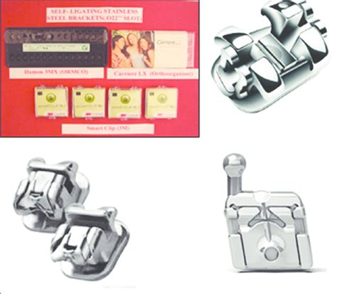 Self‑ligation Brackets Download Scientific Diagram