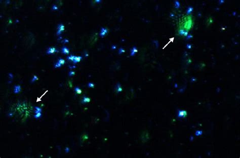 Nanobubble Size And Concentration Analysis With Multi Laser Nanoparticle Tracking Analysis Nta