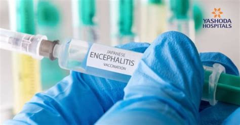 Encephalitis Types Symptoms Causes Risk Factors Diagnosis And