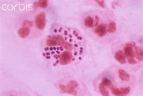 Gram Negative Oxidase Positive Rods Flashcards Quizlet
