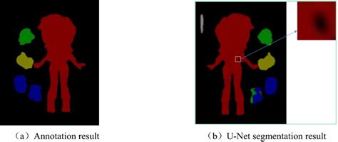 the comparison of the u net segmentation result and the annotation