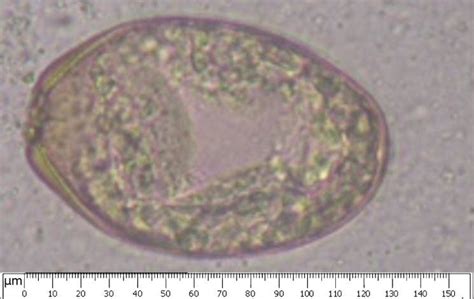 Fasciolopsisbuskioznaczone