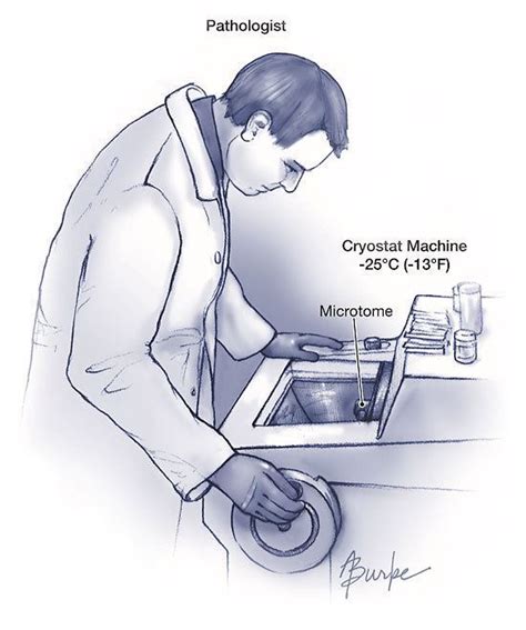 Frozen Section Procedure Alchetron The Free Social Encyclopedia