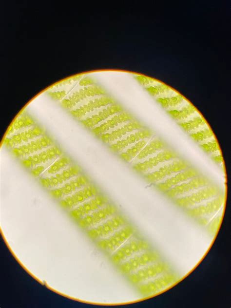 Spirogyra Alga Object Detection Dataset And Pre Trained Model By Fcu