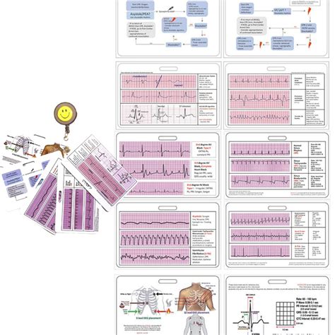 Printable Ekg Cheat Sheet