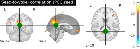 Producing Single Subject Maps Of Seed To Voxel Correlation Nilearn