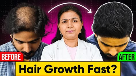 Hair Growth Tips Regrow Your Hair Fast Without Wasting Any Time Youtube