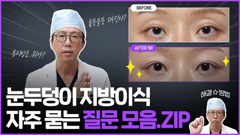 눈두덩이 지방이식 👀 꺼진 눈 피곤한 눈 살리는 눈두덩이 지방이식에 대해 많았던 질문들 모아모아 명확하게 답변해드려요
