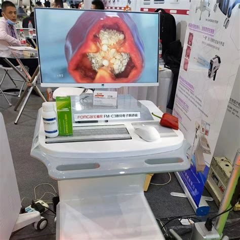 Colposcope Digital Imaging System Gynecological Colposcope Colposcopy