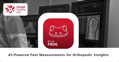 Imagebiopsy Lab Launches Ib Lab Frog Ai Powered Foot Measurements For Orthopedic Insights