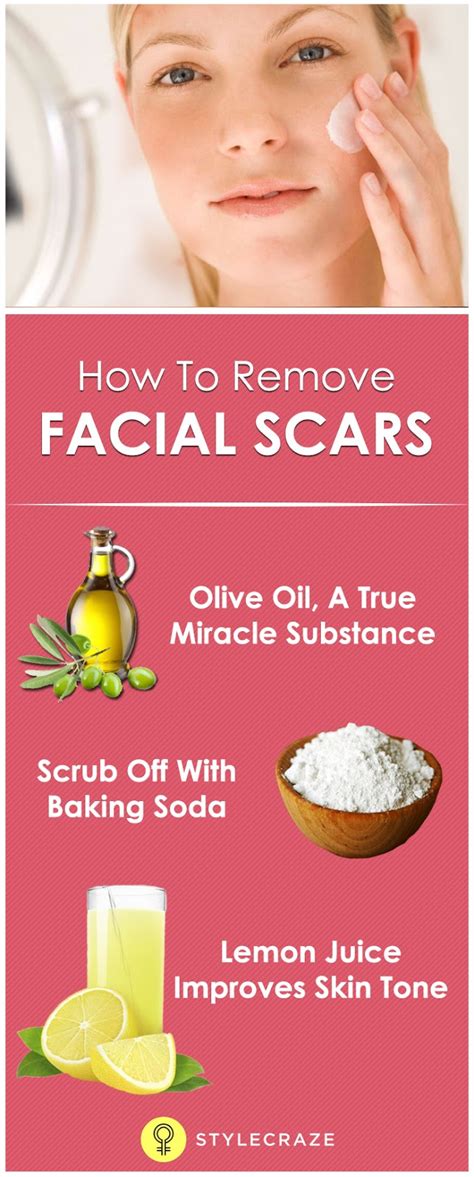 How To Remove And Reduce Facial Scars الطب البديل