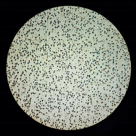 Prerak Vikani On Linkedin Beautiful Microstructure Of Spheroidal