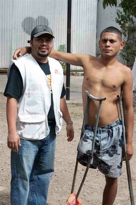 Honduran Rak Cx Hunk Honduran Crutches Amputee He Loves Me Special