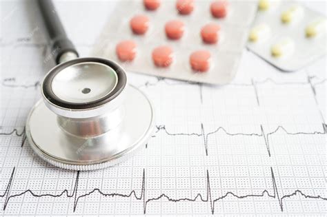 Stéthoscope Sur électrocardiogramme Ecg Avec Rapport De Cardiogramme De