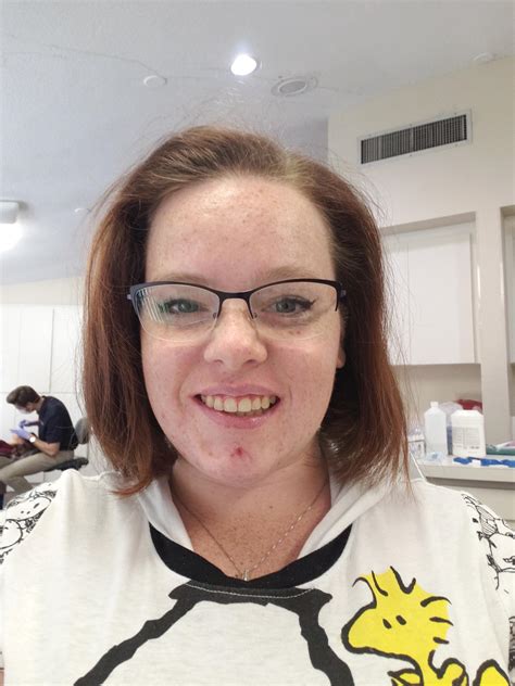 The Braces Are Off Scrolller