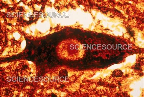Motor Neuron Structure Stock Image Science Source Images Motor Neuron Structure Stock Image Science Source Images