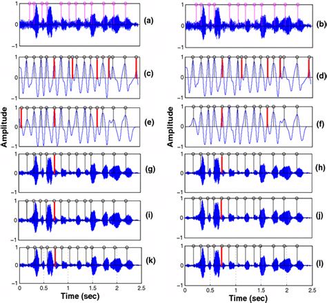 Speech Enhancement And The Improved Vop Detection For Babble Noise A