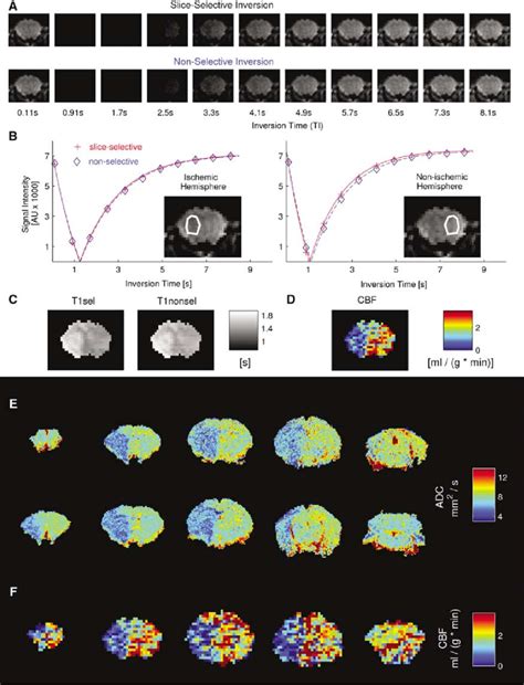 In Vivo MRI Measurement Of Perfusion And Diffusion During And After Download Scientific Diagram