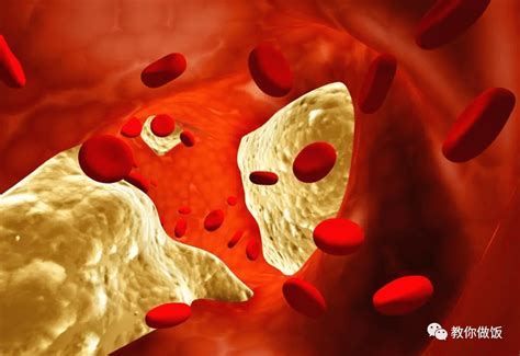 蛋黄胆固醇高，高血脂病人不能吃？血脂升高的“真凶”另有其人 血液 疾病 食物