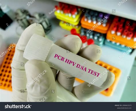 Virus Reduction Images Stock Photos Vectors Shutterstock