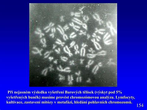 Ppt Sex Testy Powerpoint Presentation Free Download Id3037857