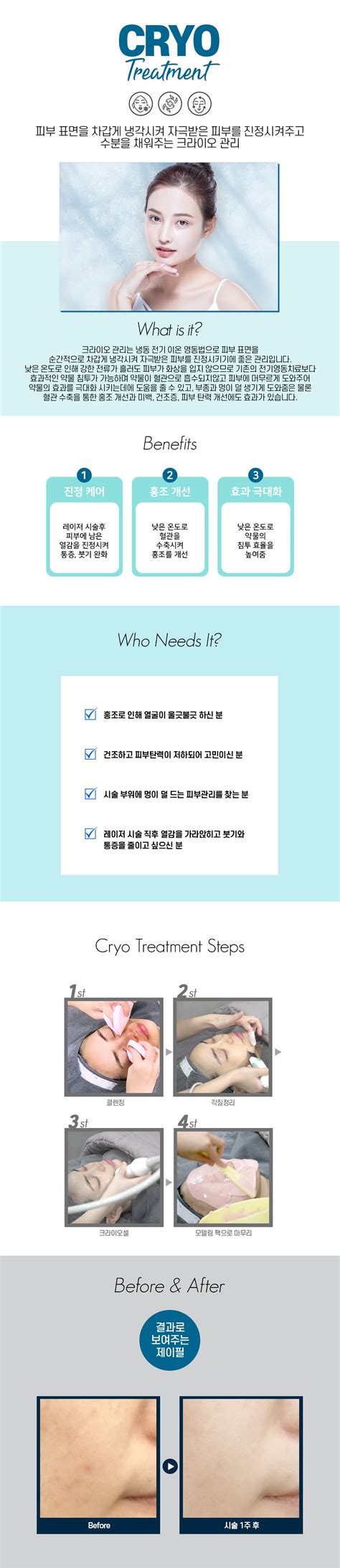 크라이오관리 제일이쁜느낌 제이필의원 홍대 피부과 리프팅 전담병원울쎄라 인모드 슈링크 올리지오 필러 장인 스킨부스터리쥬란힐러 엑소좀맛집