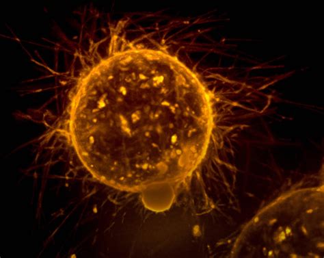 Exploring The Breast Cancer Dataset With Python And Scikit Learnsklearn