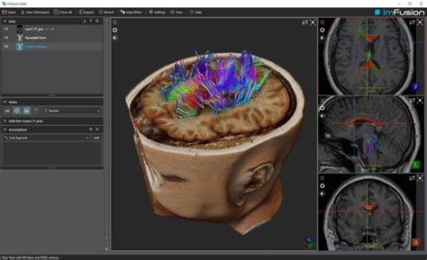 Sdk Medicalimaging Newplugin Imfusion Gmbh