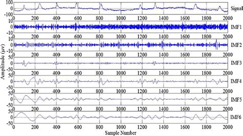 The Emd Of Right Hand Mi Task Eeg Signal Into Imfs 92 Download