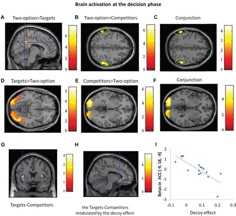 Brain Activation At The Decision Phase Regions With Significant Download Scientific Diagram