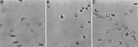 Red Blood Cells Microscope Hypertonic