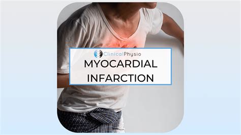 Myocardial Infarction Clinical Physio Membership