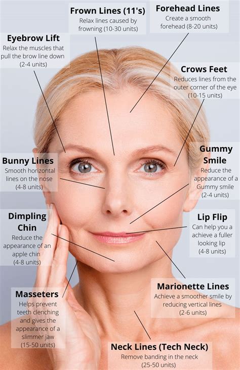 Botox Injections Salt Lake City Ut Dysport® Park City Botox Botox