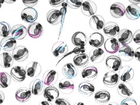 What Drives Nephrotic Syndrome Hypercoagulopathy Pediatrics Nationwide