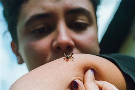 Travellers Guide To Infected Insect Bites Tips For Staying Safe In