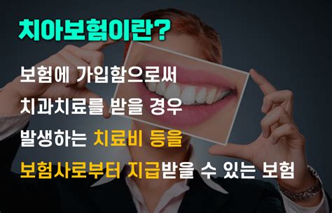 메리츠치아보험 보장항목 및 가입시 주의사항진단형 무진단형 면책기간 감액기간 네이버 블로그
