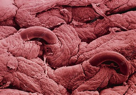 False Col Sem Of Trichostrongylus Vitrinus Stock Image Z180 0044